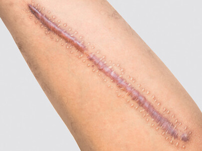 Scars - Juzo