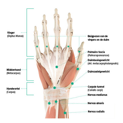 Pijn in de hand – oorzaken en behandeling - Juzo
